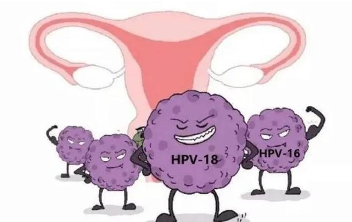 HPV是妇科疾病还是性病？4个HPV有效预防方法 - 知乎