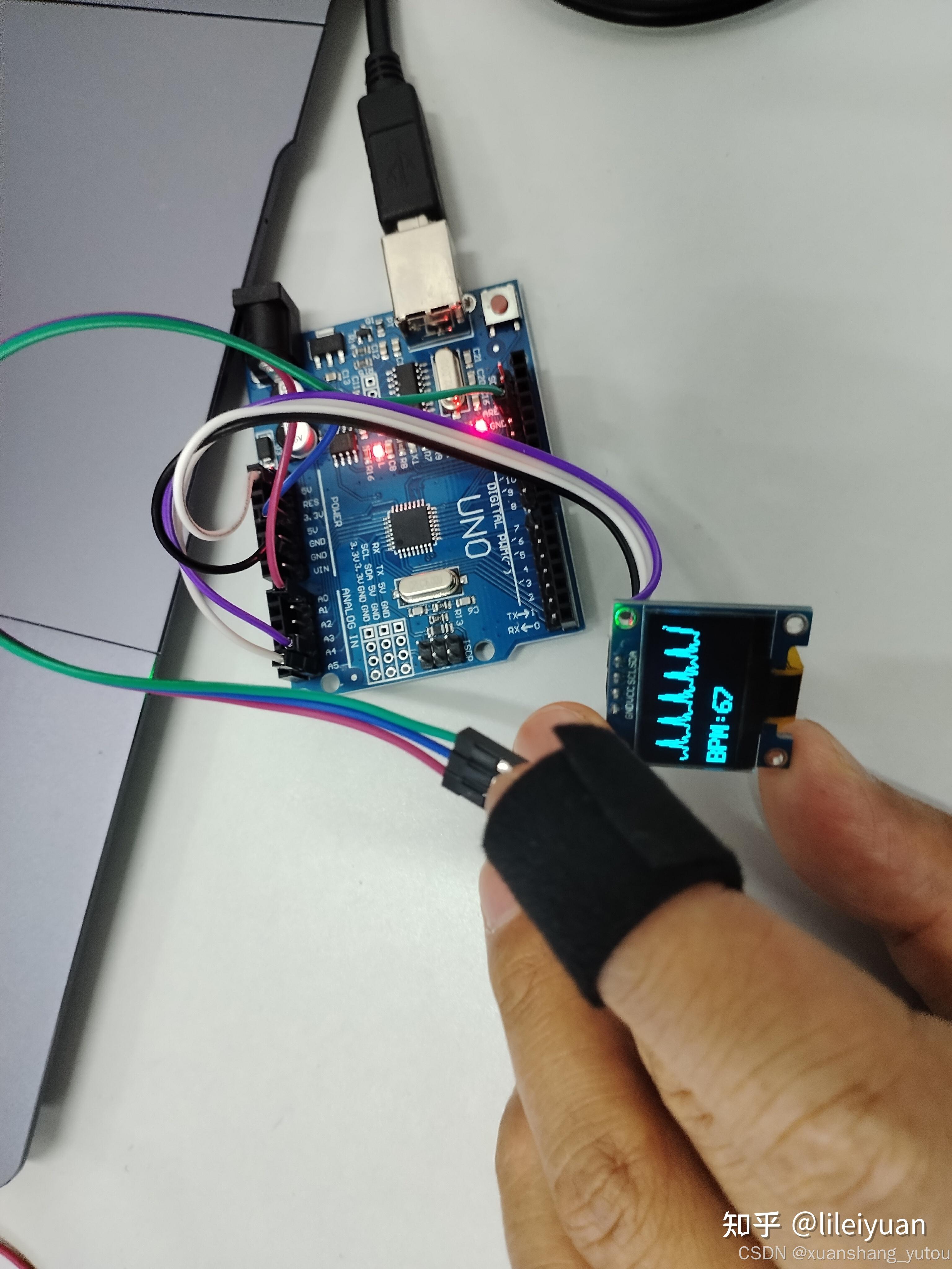 Arduino UNO驱动OLED屏幕显示Pulse Sensor传感器心率波形和数值 PC端Procesing软件显示PPG波形和脉搏数值 - 知乎