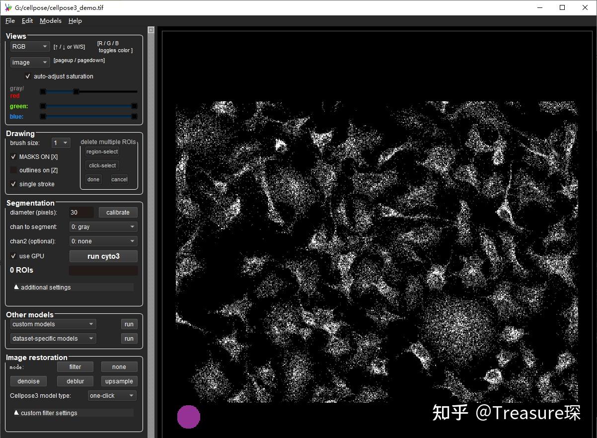Cellpose 3.0 —— 一键图像恢复+细胞分割 - 知乎