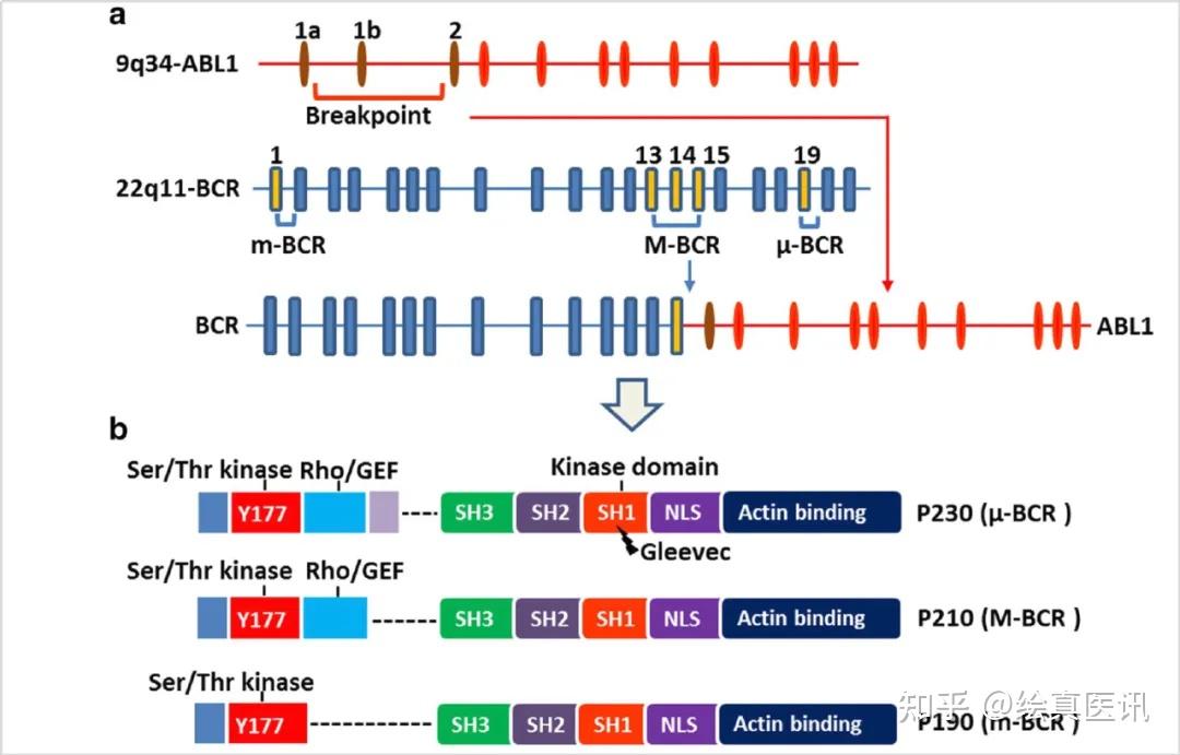【绘真科普】血液肿瘤BCR-ABL1融合变异检测，该注意哪些事项？ - 知乎