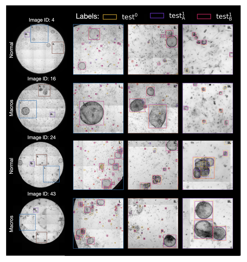 MultiOrg: A Multi-rater Organoid-detection Dataset 多标注者类器官检测数据集介绍 - 知乎