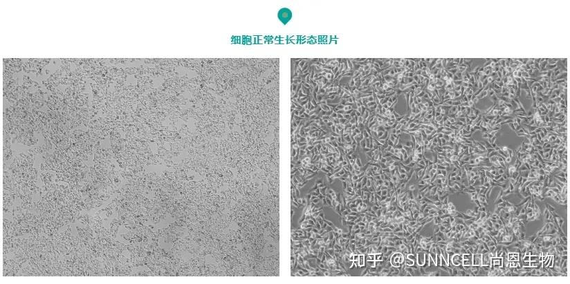 B16(小鼠黑色素瘤细胞)培养教程 - 知乎