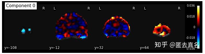 nilearn 笔记（16） - 知乎