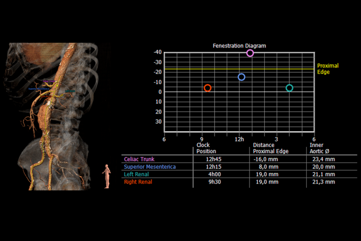3mensio vascular - 知乎