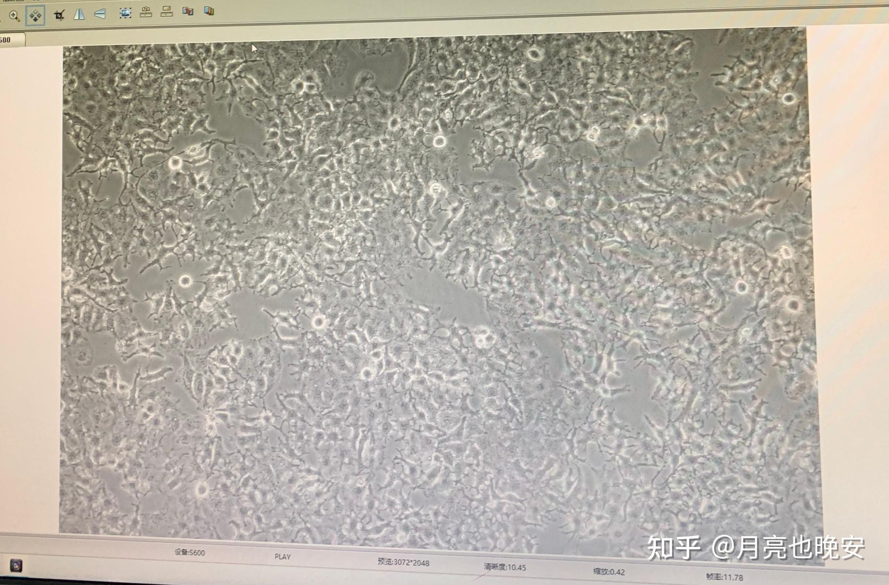Huh-7细胞形态是怎样的？我最近养的细胞形态是Huh-7该有的样子吗？ - 知乎