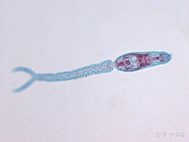 华支睾吸虫 - 知乎