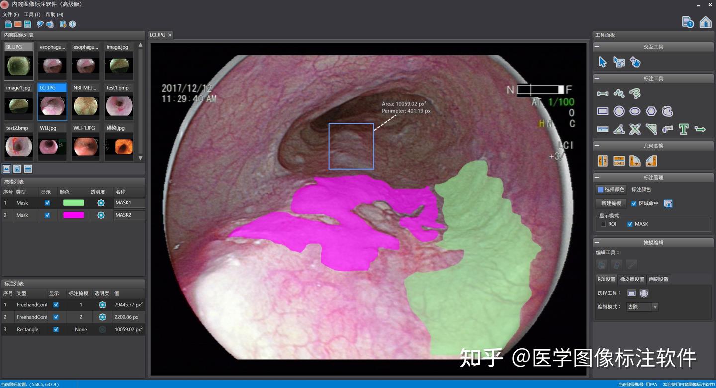 助力医学临床AI — MISAT医学图像分割与标注软件套装 - 知乎