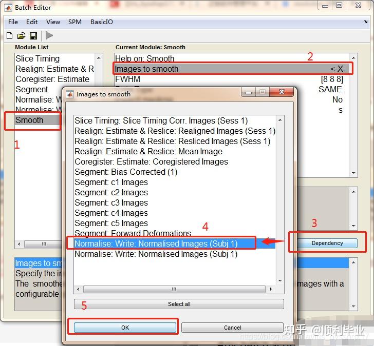 MRI数据预处理 - 知乎