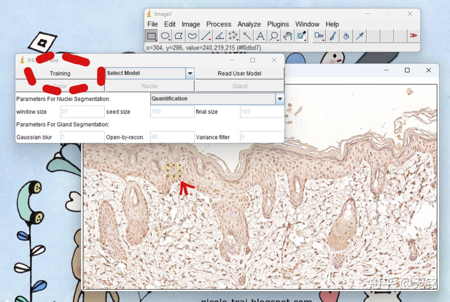 如何使用 imageJ 软件分析组织切片免疫组化面积？ - 知乎