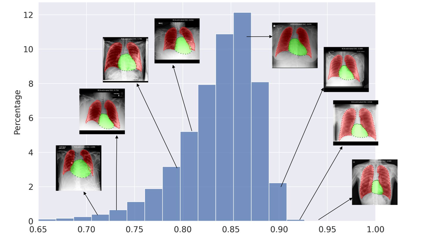 CheXmask Database 数据集介绍 - 知乎