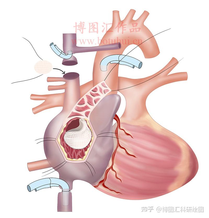 科研美图SCI插图封面图摘要图图文摘要TOC图 - 知乎
