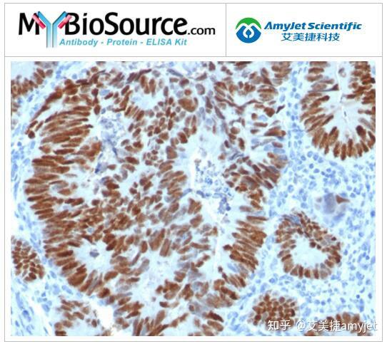 MyBioSource p53 肿瘤抑制蛋白 (TP53)，多克隆抗体 - 知乎