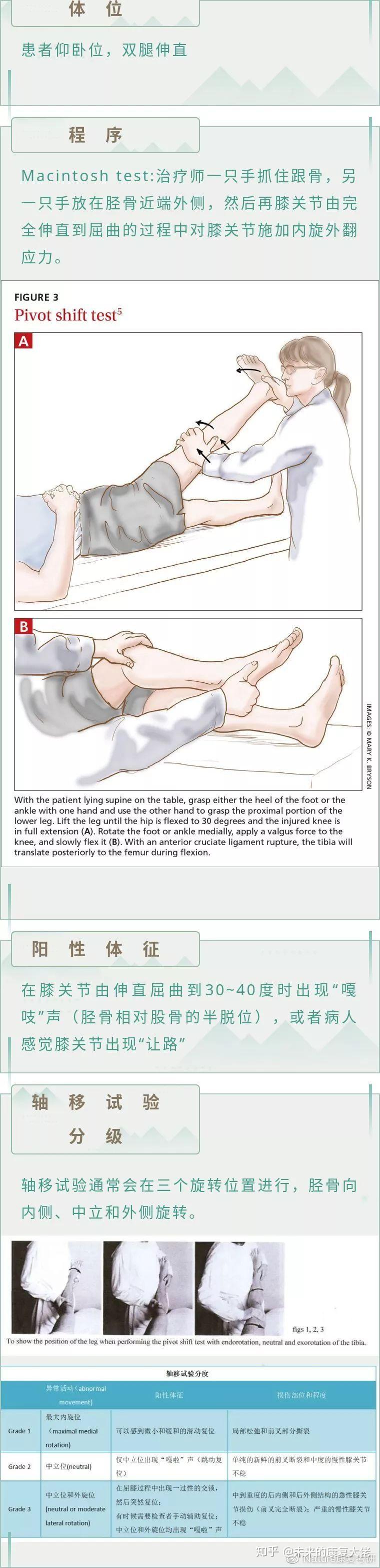 特殊试验一周汇总之膝关节 - 知乎
