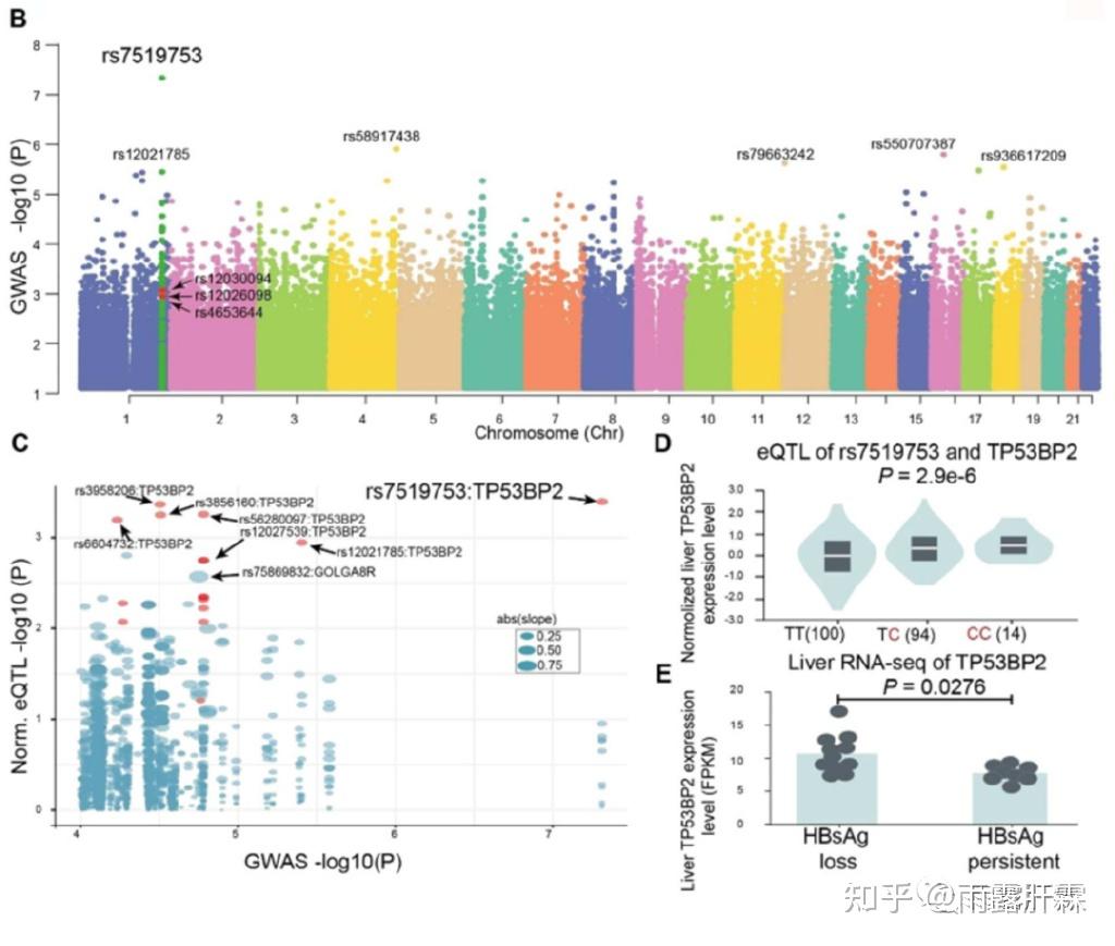 【AASLD2023速递】鲁凤民教授团队：TP53BP2可预测聚乙二醇干扰素α治疗的临床治愈率 - 知乎