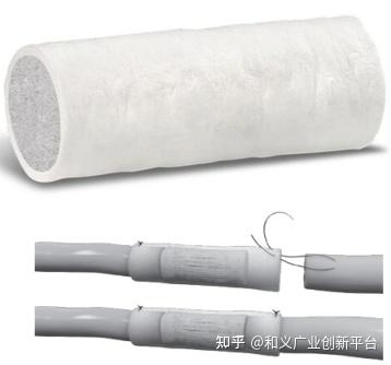 盘点外周神经系统修复相关公司及其产品 - 知乎
