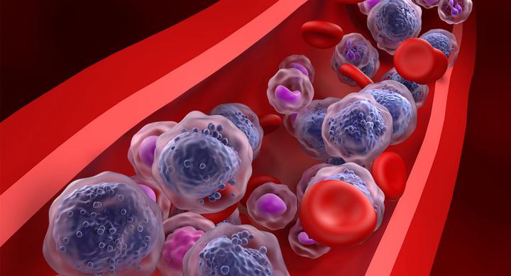 2023年末重磅：Rezlidhia(olutasidenib)未来可用于治疗复发或难治性 (R/R) AML、高危骨髓增生异常综合征(MDS ...