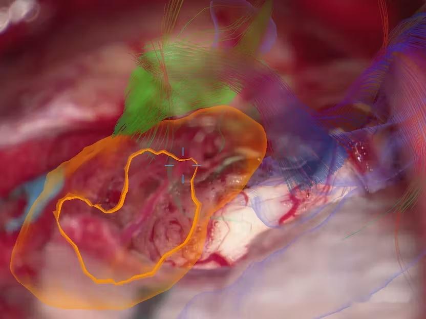 这也算机器人？眼科老大的机器人手术显微镜 - 知乎