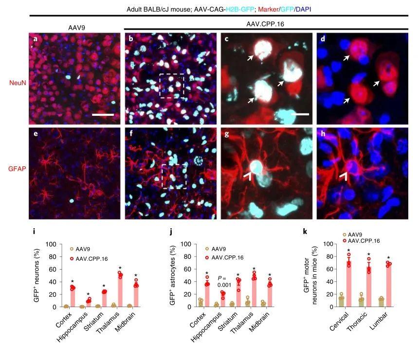 AAV能突破CNS疾病基因治疗的血脑屏障吗？ - 知乎