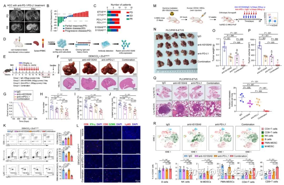 Gut（IF=23）ETV5：肝癌免疫逃逸的“幕后推手” - 知乎