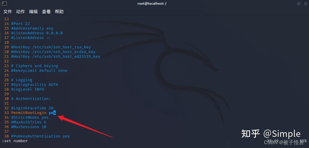 Xshell连接Kali - 知乎