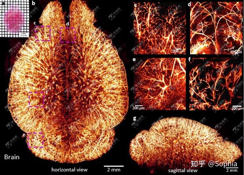FDISCO组织透明化方法的特点及应用 - 知乎