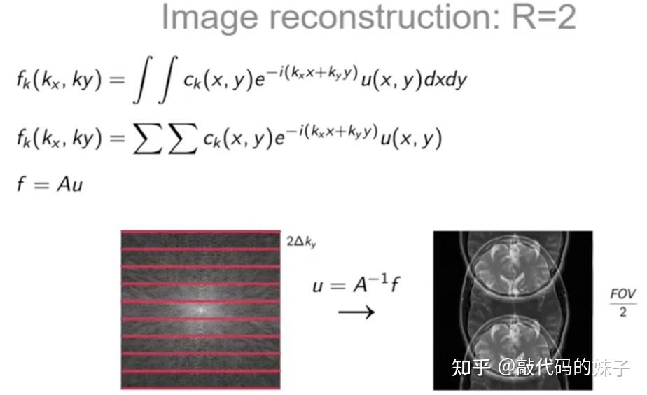 Introduction to Deep Learning for MR Image Reconstruction(compressed ...