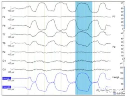 一文详解脑电图（EEG）的原理与应用 - 知乎