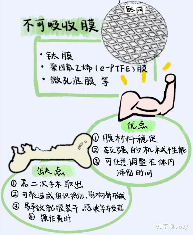 引导骨再生膜比对分析——贝奥吉因CDMO - 知乎