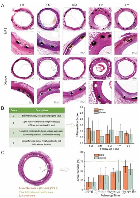 《AHM》：安全植入人体的可生物降解金属-聚合物复合支架 - 知乎