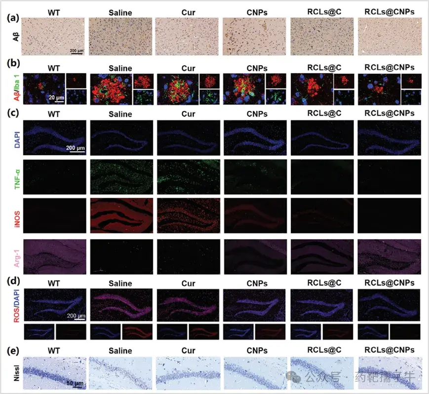 文献学习-Small（IF=13.0）：姜黄素自组装纳米颗粒结合并抑制Aβ聚集调节小胶质细胞极化 - 知乎
