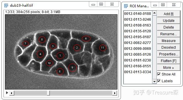 ImageJ实用技巧——3D细胞自动分割(插件篇) - 知乎