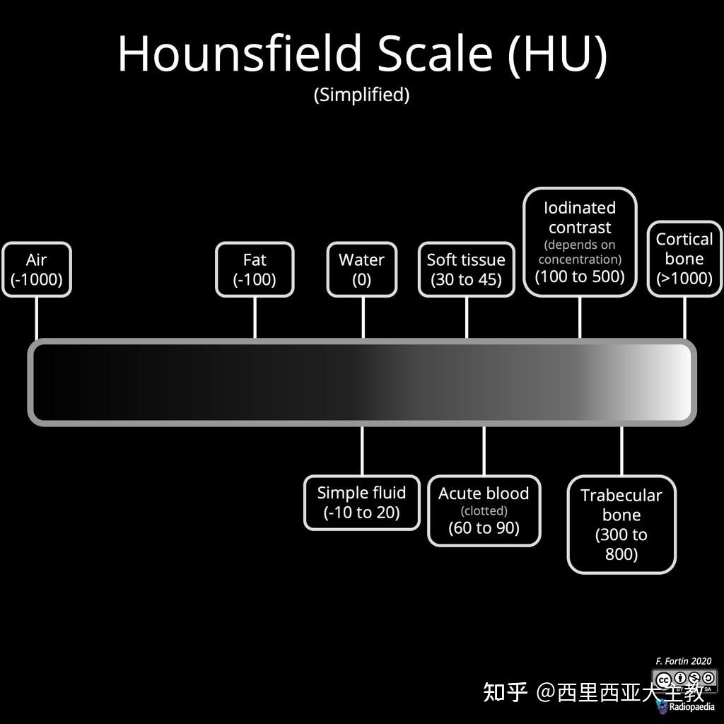 章节一: CT (computed tomography) 计算机断层扫描 - 知乎