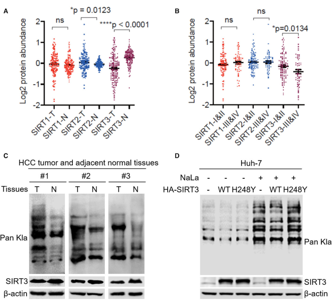 EMBO Rep | 中国科学技术大学王毅团队揭示CCNE2乳酸化修饰促进肝细胞癌进展的新机制 - 知乎
