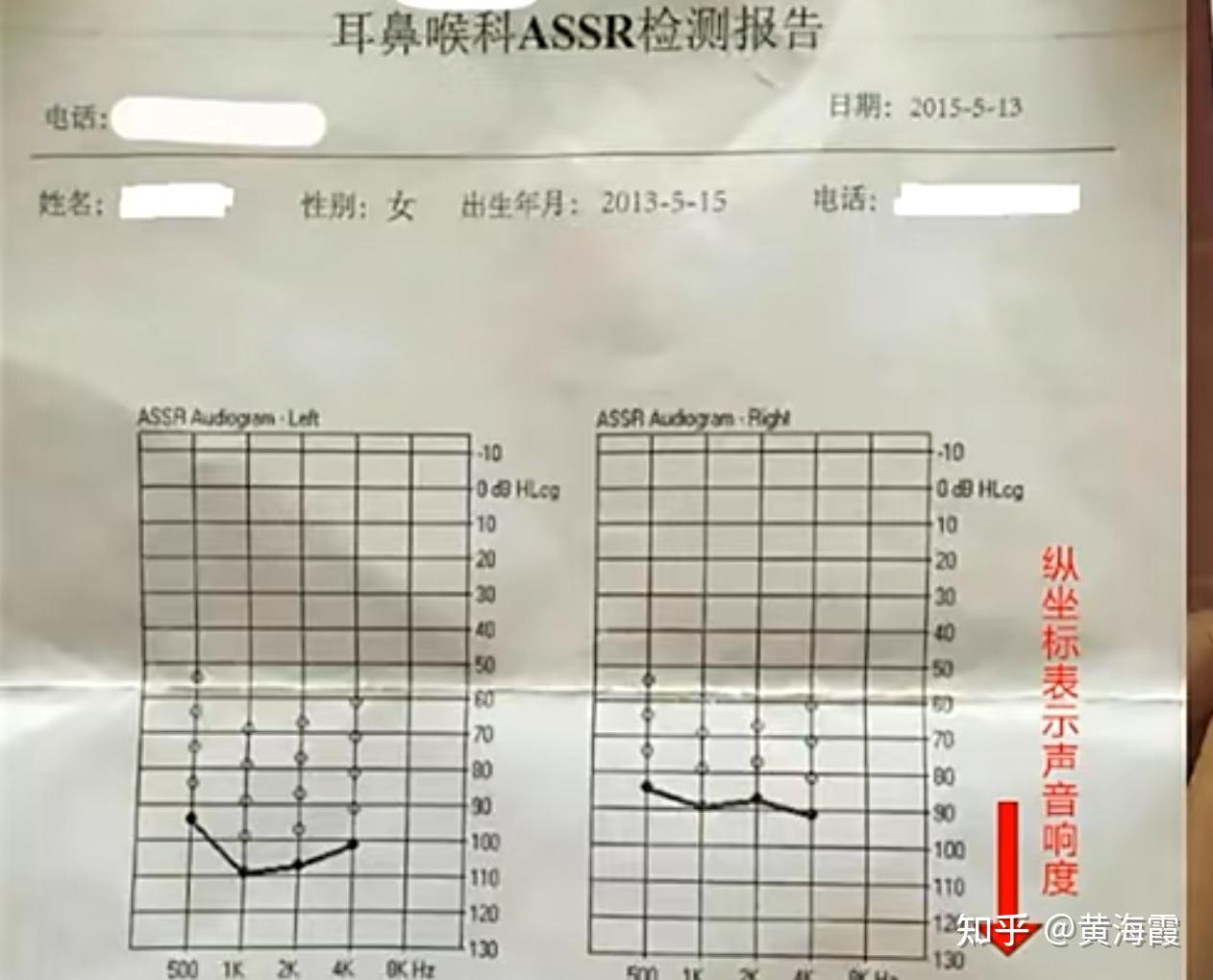 如何解读ASSR报告呢？ - 知乎