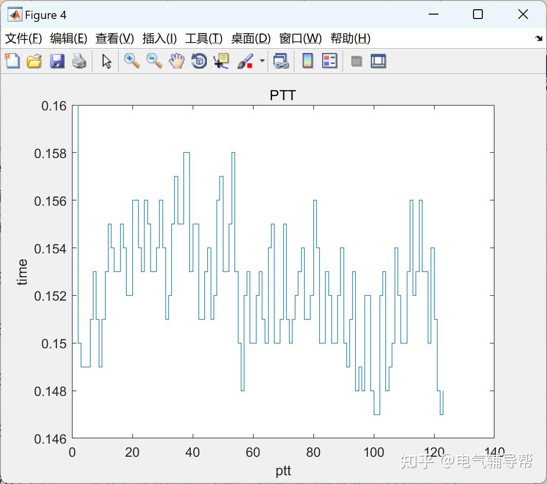 ECG和PPG信号用于PTT、HRV和PRV研究（Matlab代码实现） - 知乎