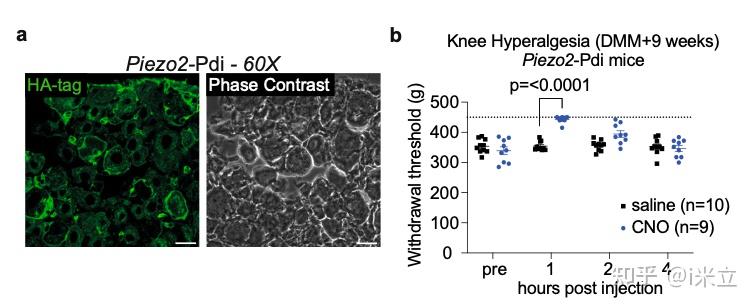 IF:17.694|Piezo2：一个治疗骨关节炎疼痛的新靶点 - 知乎