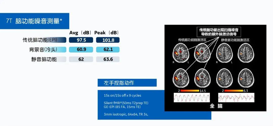 正式发布！SIGNA™ 7T引领科研 共创精准转化 - 知乎