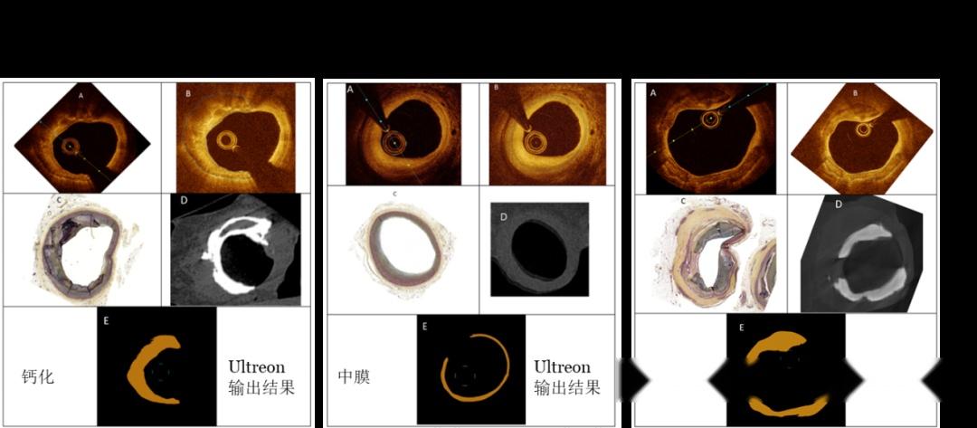 CCEC·前沿技术｜当人工智能“预见”OCT - 知乎