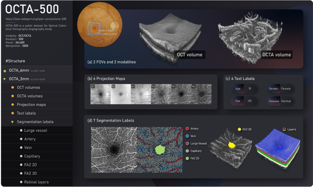 OCTA-500 数据集介绍 - 知乎