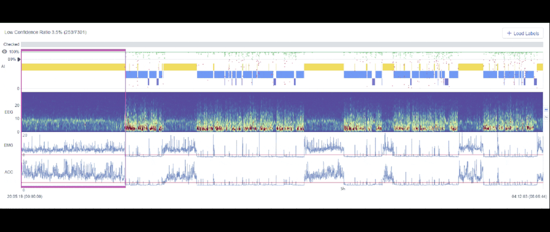【脑科学】动物睡眠病状中的REM Sleep - 知乎