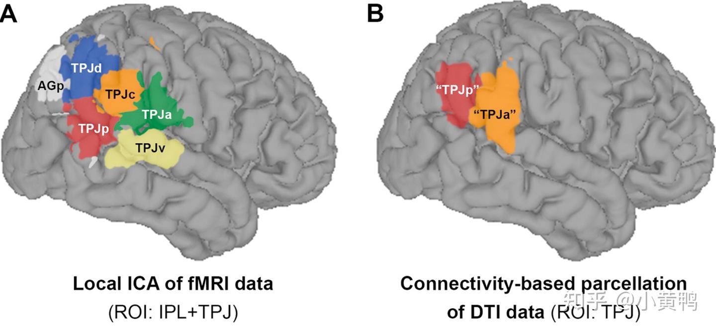 颞顶联合区（TPJ）与注意功能 - 知乎