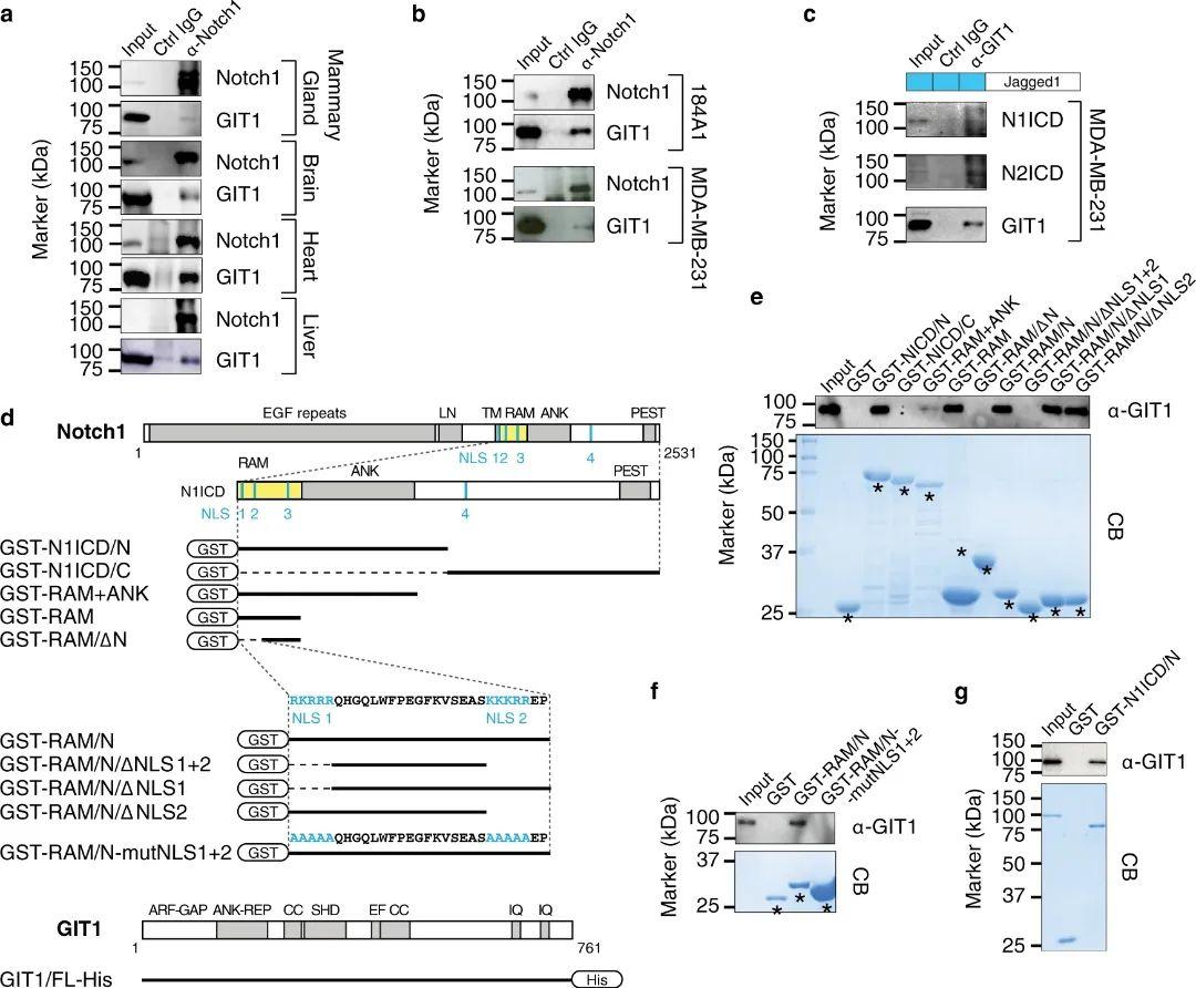 Nat Commun︱卡罗林斯卡医学院发现GIT1抑制乳腺癌生长并可评估患者预后风险 - 知乎