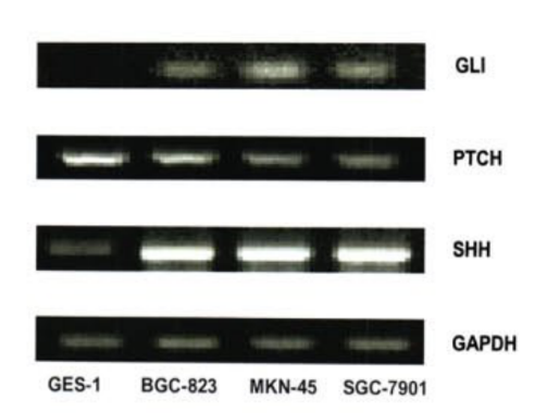 环巴胺抑制剂修饰奥沙利铂/GLUT-OXA 葡萄糖转运蛋白抑制剂修饰奥沙利铂 - 知乎
