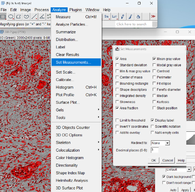 解忧小工具｜保姆式教程！用Image J进行免疫组化分析（IHC score评分） - 知乎