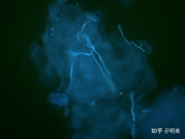 荧光生物显微镜应用于皮肤科快速检查真菌感染 - 知乎