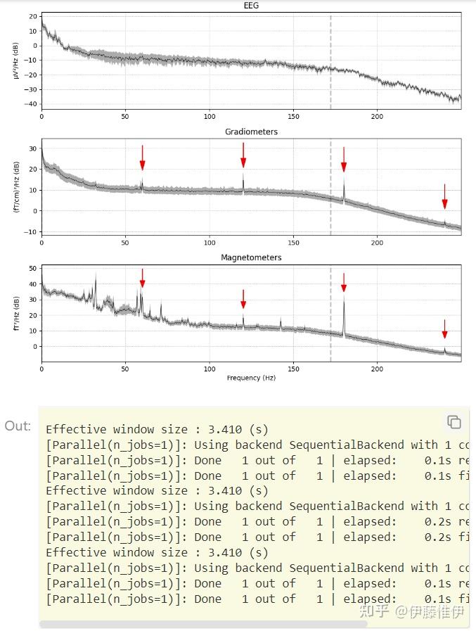 preprocessing——artifact detection - 知乎