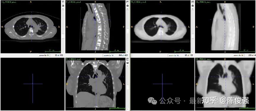 SynthRAD2025——用于放射治疗的计算机断层扫描生成挑战赛 - 知乎