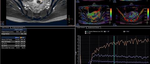 磁共振动态扫描 MRI Dynamic Scan