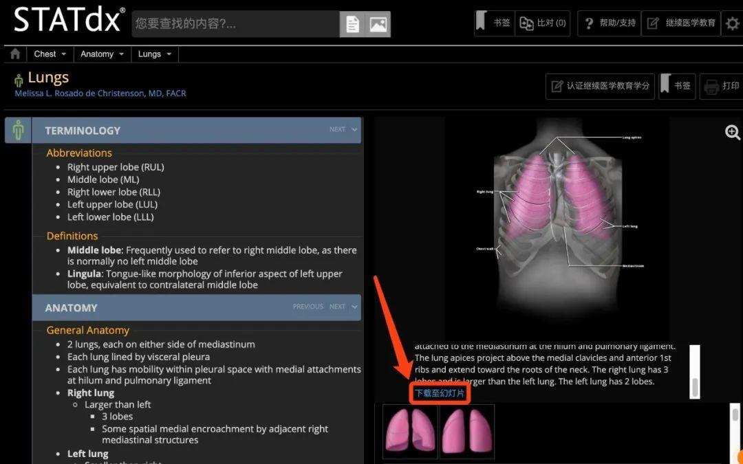手把手教程：美国医生广泛好评的影像学工具STATdx用户指南 - 知乎