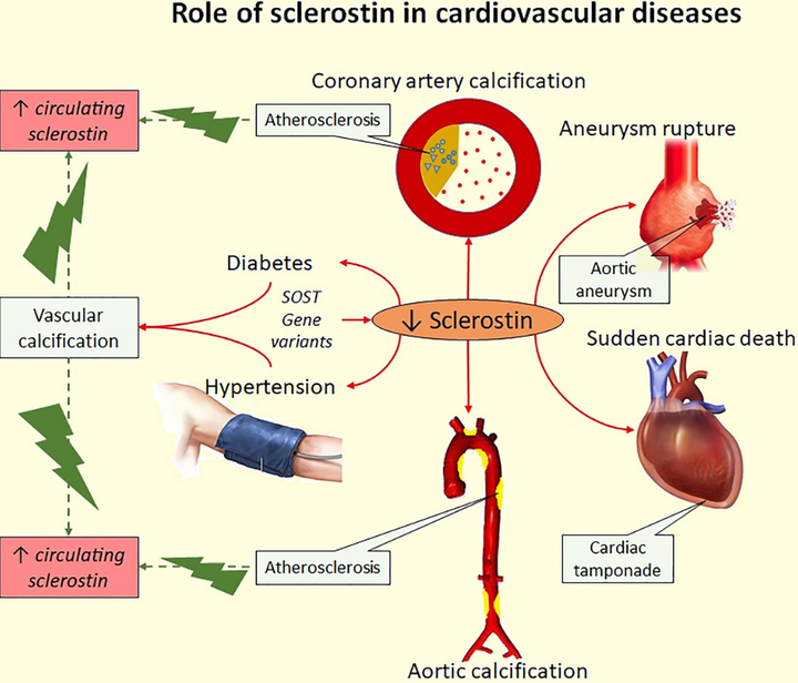 SOST细胞筛选模型 - 知乎